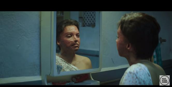 Chhapaak Trailer: Deepika Padukone stuns as acid-attack survivor! Hindi ...